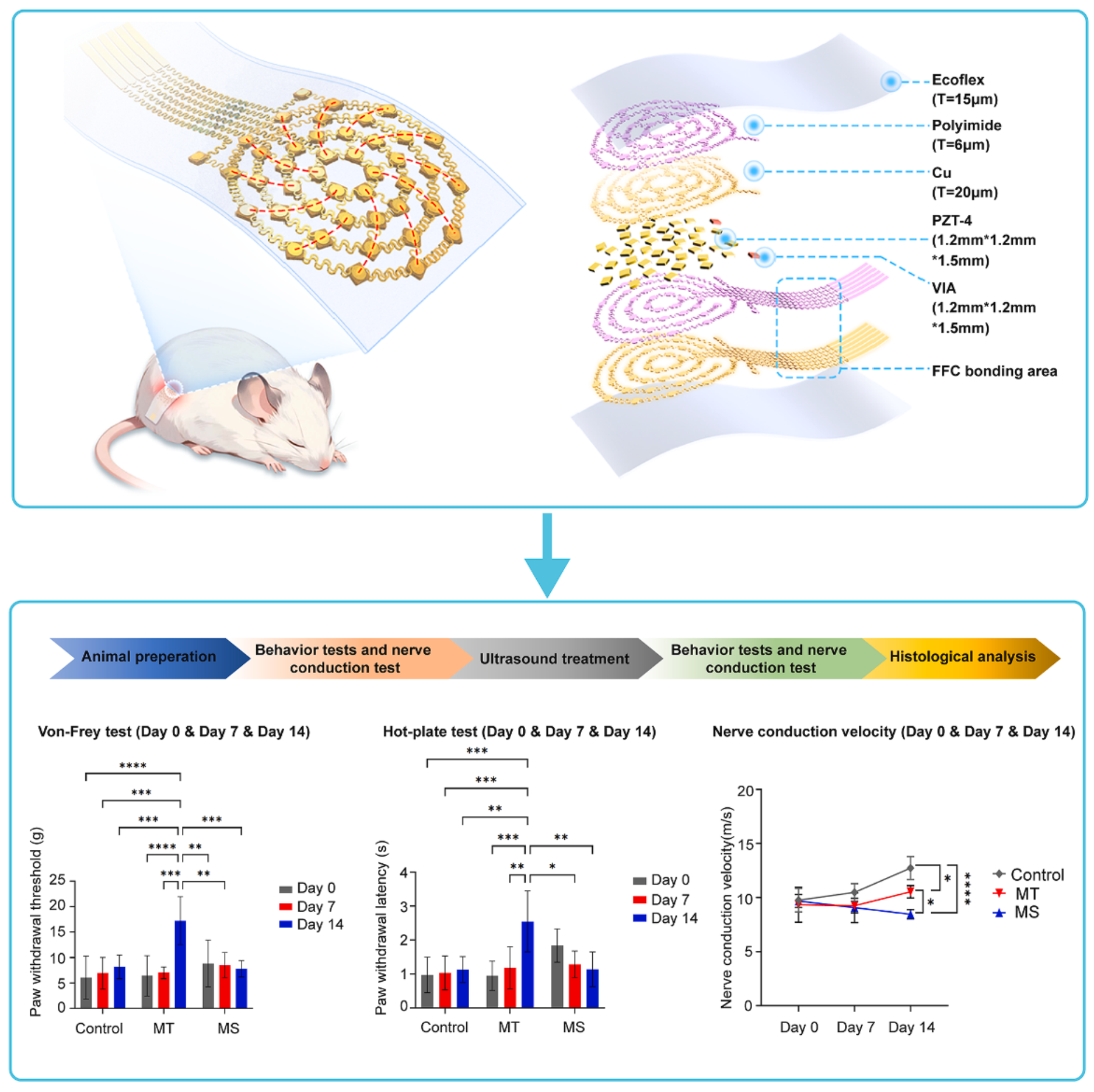 Wearable Ultrasound Patch Offers Non-Invasive Relief for Diabetic Nerve ...